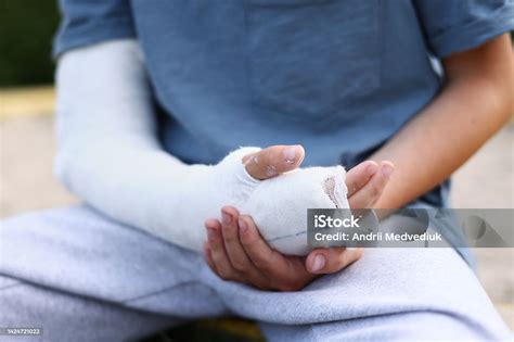 아이의 팔이 부러졌습니다 야외에서 팔다리가 골절 된 어린 소년 여름 휴가철에 골절 부상 아이는 팔에 석고로 손가락을 움직이고