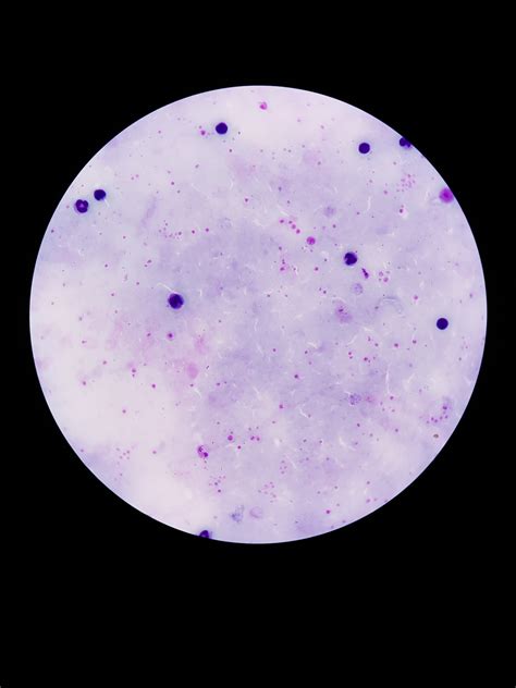 Malaria Object Detection Dataset By Malaria Fold1