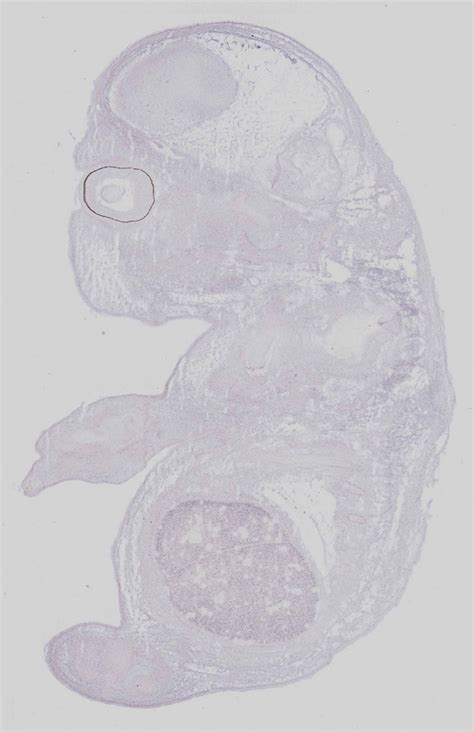Cr1l Mgi Mouse Gene Detail Mgi88513 Complement C3bc4b Receptor 1 Like