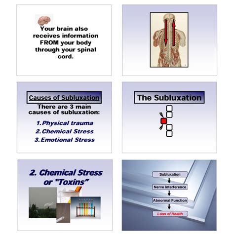 Chiropractic Orientation PowerPoint Presentation CD ChiropracticArt