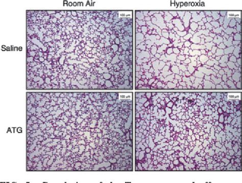 Figure 5 From Thiol Redox Regulation In Lung Development And Vascular