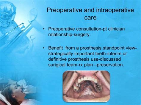 Removal Partial Denture Considerationsin Maxillofacial Prosthetics Pptx