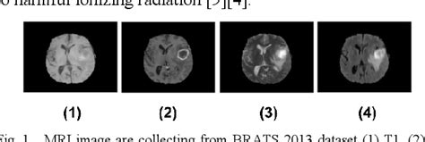 Figure 1 From Review Of Brain Mri Image Segmentation Based On Deep