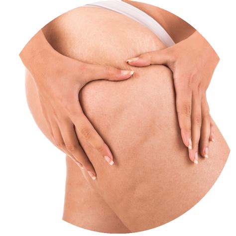 Clínica Smer Cirugías Reparatorias Santiago