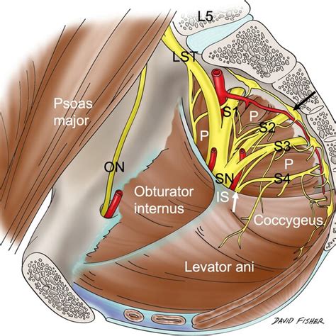 Schematic Drawing Of The Female Pelvis From A Hemipelvectomy View