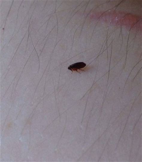 Help Is This A Flea BabyCenter