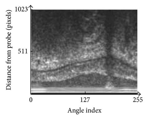 boundary calculation procedure a ivus image in cartesian coordinate