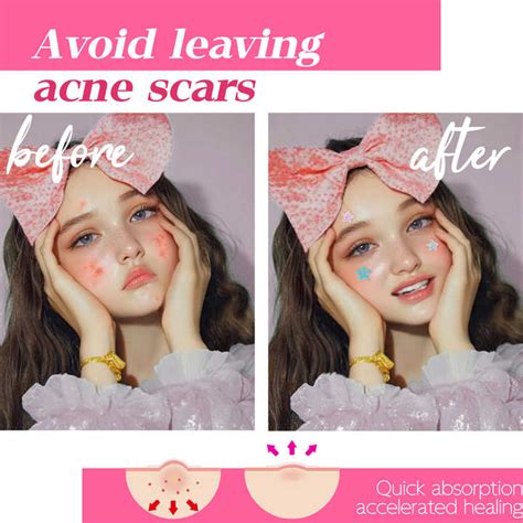Glitter Design Hot Selling Pimple Patch Hydrocolloid Acne Patch For