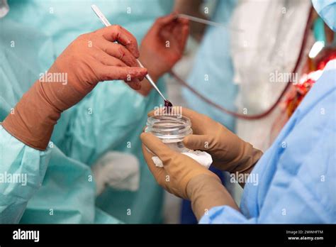 The Doctor Shows The Cancerous Tumor That He Removed During The