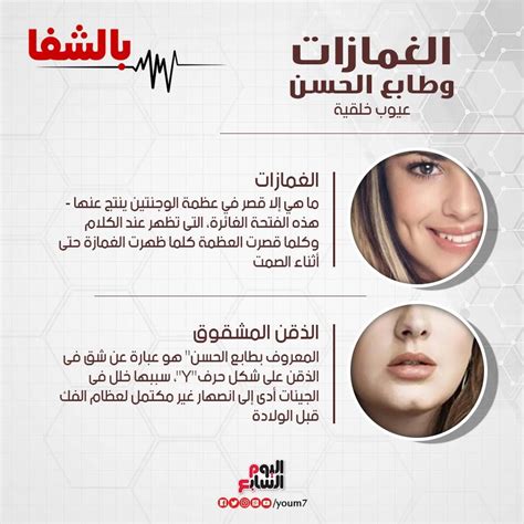 الغمازات وطابع الحسن طلعوا عيوب خلقيه هههههههه 😂😂😂👌 Lol Discover Life