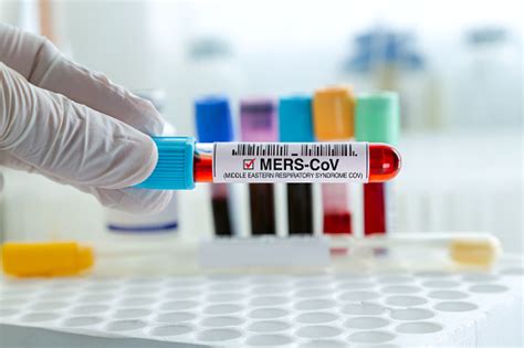 Merscov 바이러스에 양성인 혈액 샘플을 검사하는 테크니칸 낙타에 대한 스톡 사진 및 기타 이미지 낙타 감기와 독감