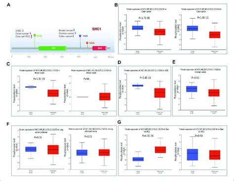 The Distribution Of Shc1 Protein Phosphorylation In Different Tumors