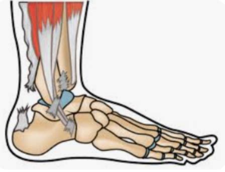 Lower Leg Foot And Ankle MSK Exam 2 Flashcards Quizlet