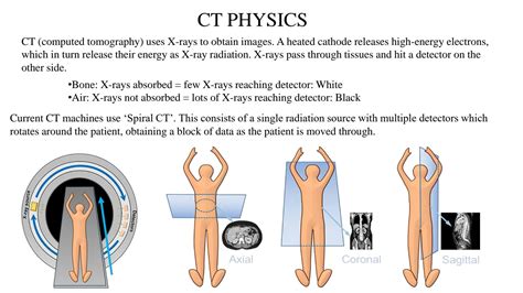SOLUTION Ct Mri Normal Pathologic Image Studypool