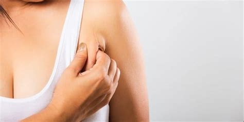 Pin En Brazo