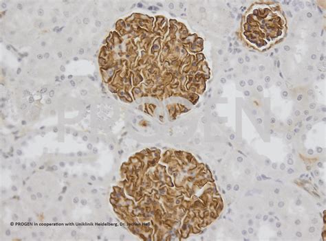 Anti Synaptopodinsynpo Mouse Monoclonal G1d4 Lyophilized Purified
