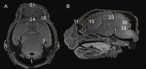 Micro Ct Imaging And Morphometric Analysis Of Mouse Neonatal Brains