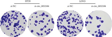 Circ0052184 Silencing Inhibited Colorectal Cancer Cell Proliferation