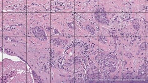 Accelerating Digital Pathology Workflows Using Cucim And Nvidia Gpudirect Storage Nvidia