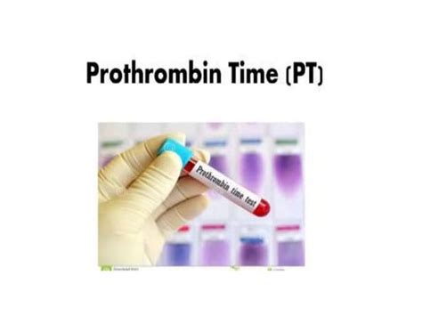 Bleeding Time And Clotting Time Pptx
