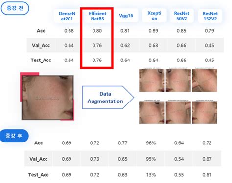 GitHub jiwoohw DL skin disease project 딥러닝 피부 병변 분류