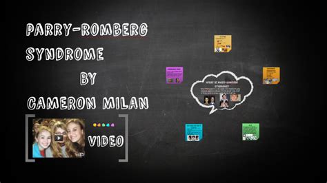 Parry Romberg Syndrome By Cameron Milan On Prezi