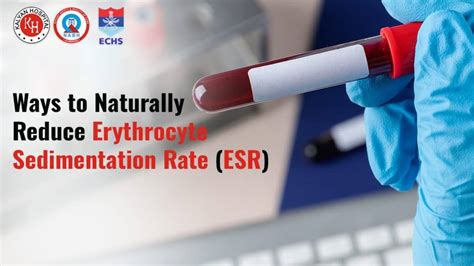 How To Decrease Erythrocyte Sedimentation Rate Safely