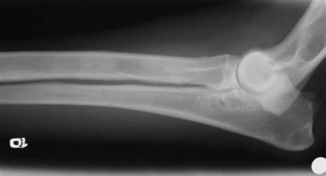 227314 Surgery And Lameness Metabolic Bone Disease And Angular Limb