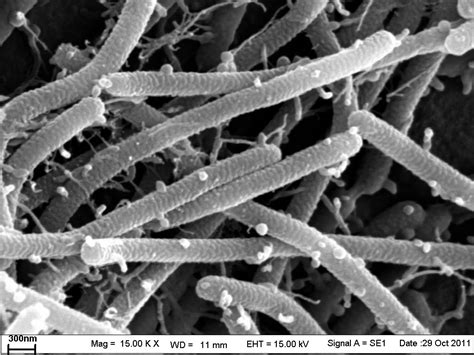 กล้องจุลทรรศน์อิเล็กตรอนแบบส่องกราด Sem