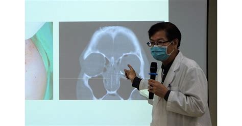 顏面骨折術後如何提升顏值？關鍵：搶救顏面骨高度差02公分 華人健康網 專業即時優質的健康新聞及資訊分享平台業即時優質的健康新聞及資訊分享平台
