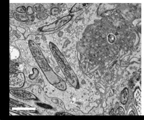 Serial Block Face Scanning Electron Microscopy Sbf Sem Of Infected