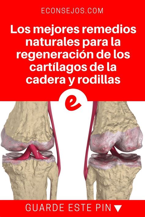 Los mejores remedios naturales para la regeneración de los cartílagos