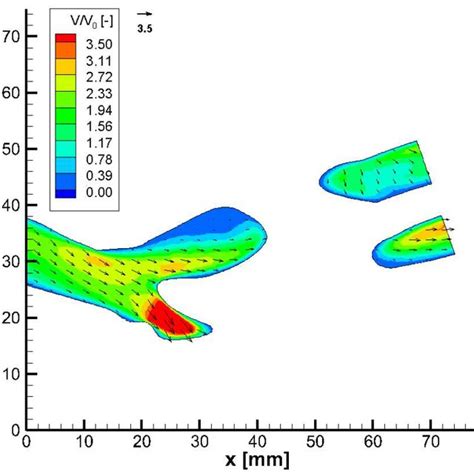Comparison Between The Piv Mri And Cfd Results In The Characteristic