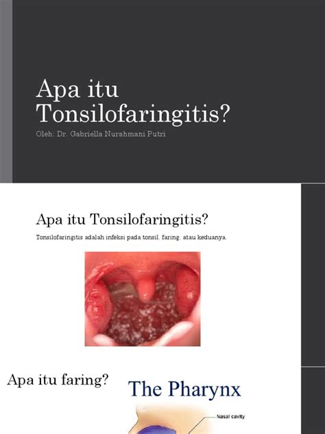 Tonsilofaringitis Penyuluhan Pdf