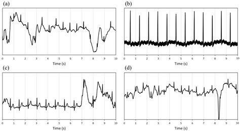 Validation Of A New And Straightforward Algorithm To Evaluate Signal