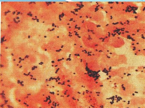 Staphylococci Introduction Staphylococci Are Grampositive Spherical Bacteria Arranged