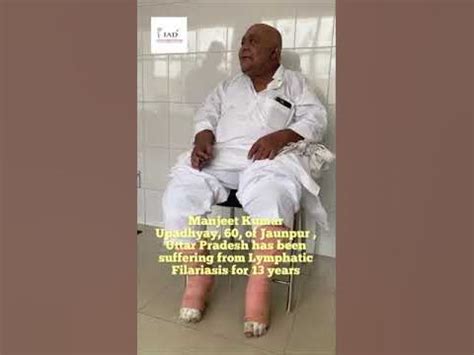Treatment For Lymphatic Filariasis Lymphedema Elephantiasis Youtube