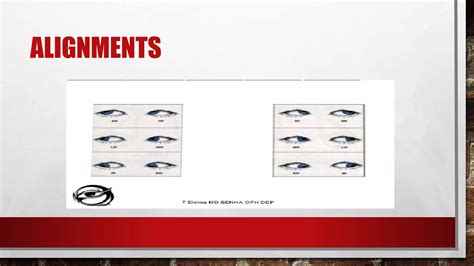 Squint Assessment Pptx