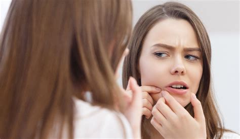 Acne Na Adolescência 7 Alimentos Que Aliviam Os Sintomas