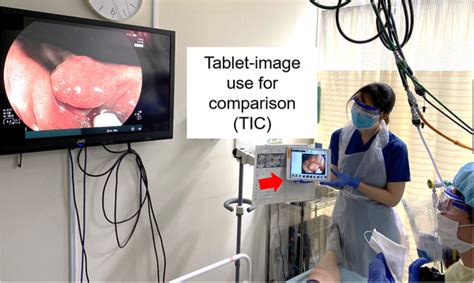 The Tablet‐image Comparison Tic Images Obtained Via The First
