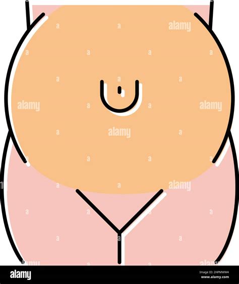 Umbilical Hernia Disease Color Icon Vector Illustration Stock Vector