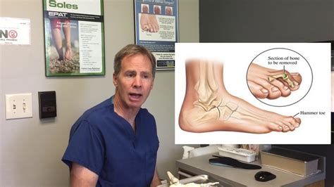 2nd Mtpj Capsulitis Deals Clearance Brunofuga Adv Br