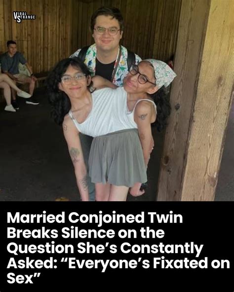 Knowledge Carmen Andrade One Of The Well Known Conjoined Twins