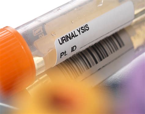 Urine