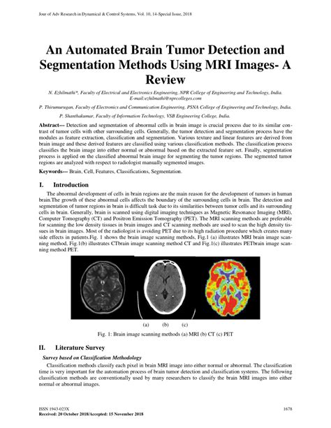 Pdf An Automated Brain Tumor Detection And Segmentation Methods Using Mri Images A Review