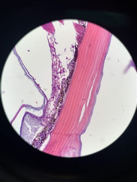 Close Up View Of The Lamellated Layers Of Chitin In A Millipede 400x Magnification Rentomology