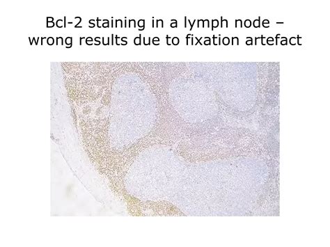 Immunohistochemistry Ppt