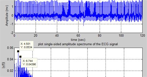 Biomedical Signal And Image Processing Projects Using Matlab And
