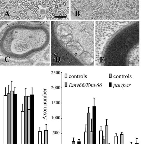 A L Extensive Vacuolization Of Neuronal Cell Bodies Semithin And
