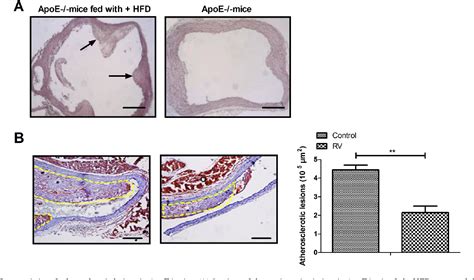 Figure 1 From Resveratrol Protects Against Atherosclerosis By